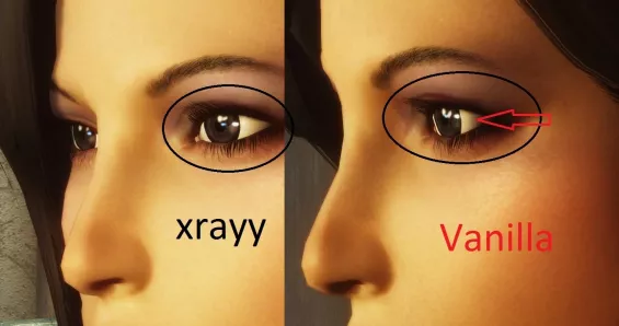 xrayys hd eye normal map SE 髪・顔・体 - Skyrim Special Edition Mod データベース ...